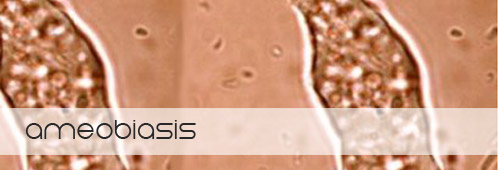 Homeopathic Medicines for Amoebiasis Treatment.