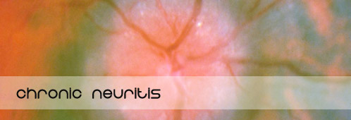 6 Best Homeopathic Medicines for Chronic Neuritis Treatment